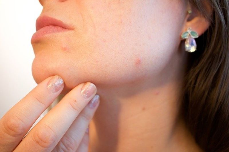 What's the difference between sensitive and sensitised skin?, Lifestyle ...