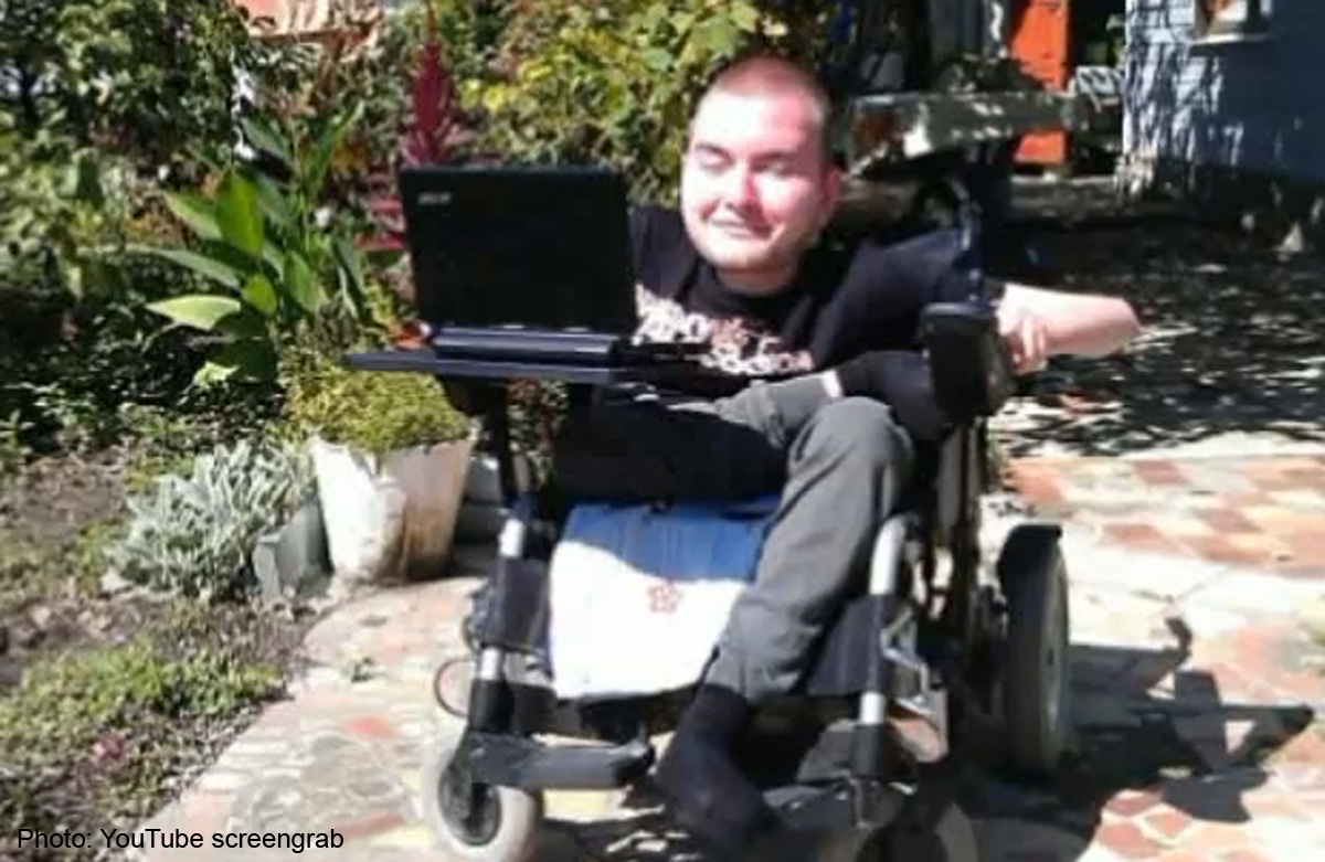 Russian man volunteers for world's first human head transplant surgery ...