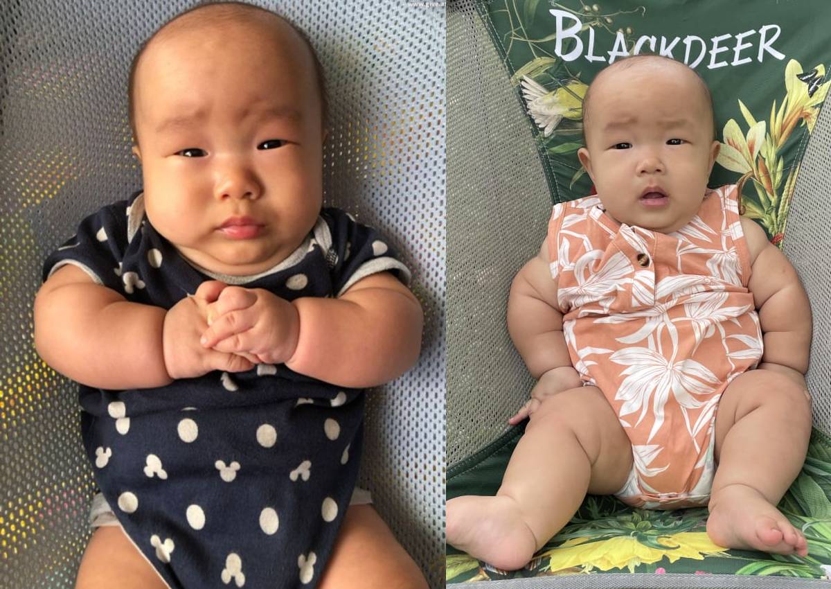 'Give him a chance to grow up pain-free and healthy': Singapore parents ...